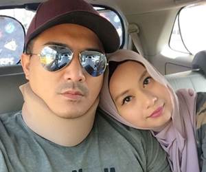 Aaron Aziz Alami Sakit Saraf Cervical Facet Arthritis